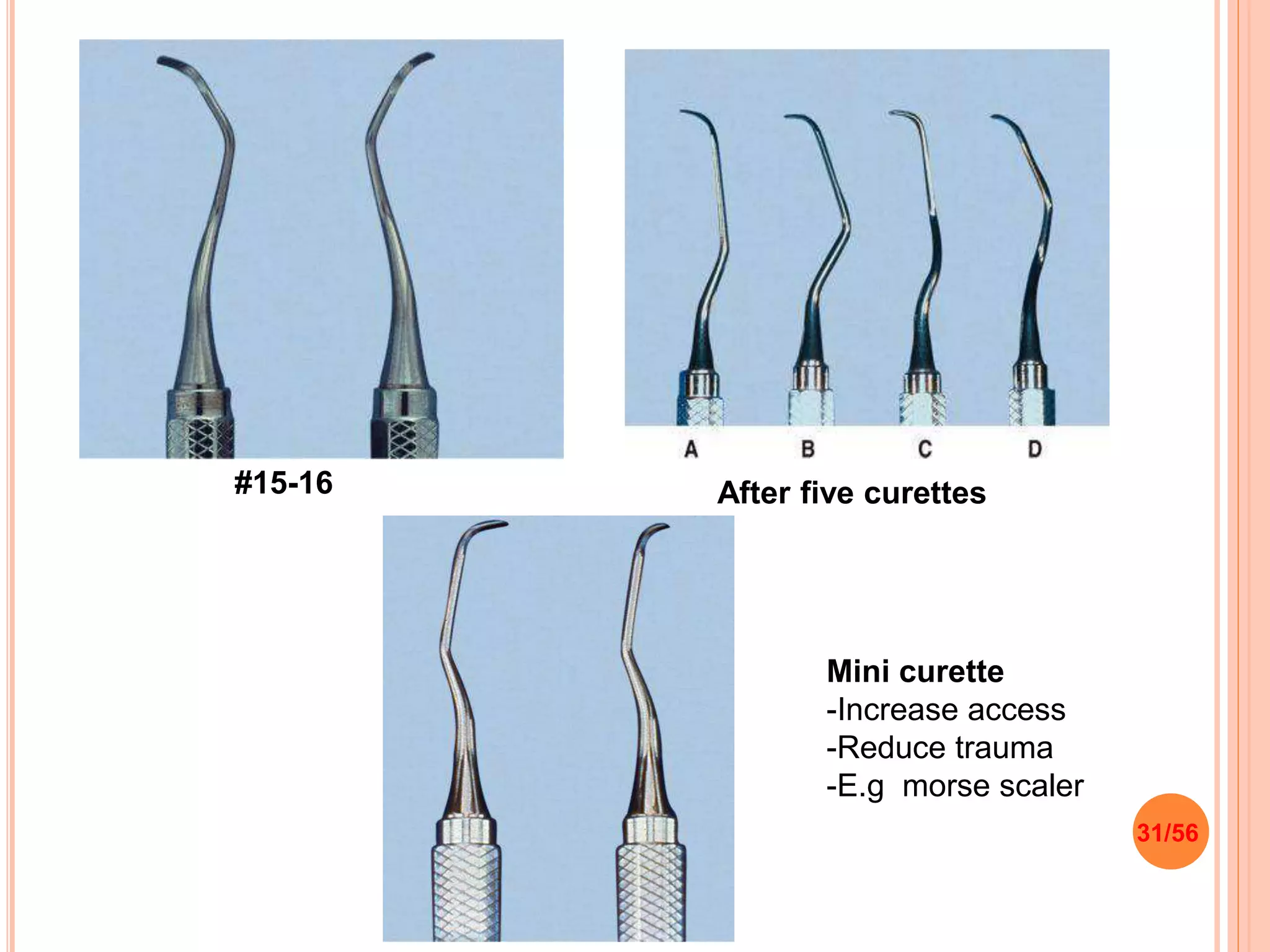 Periodontal instruments | PPTX