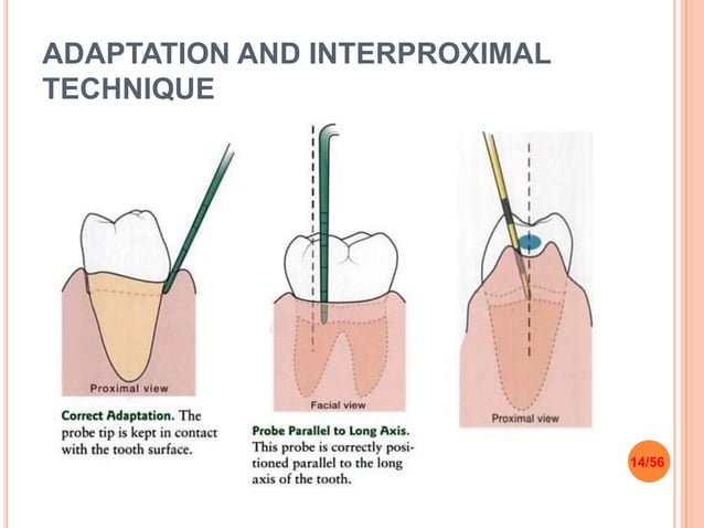 Periodontal instruments | PPTX