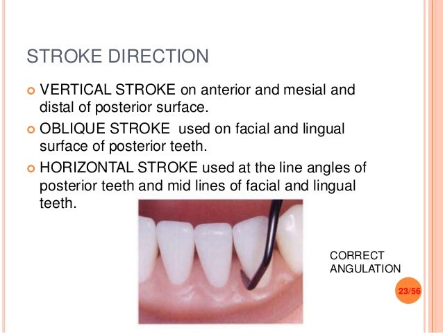 Periodontal instruments
