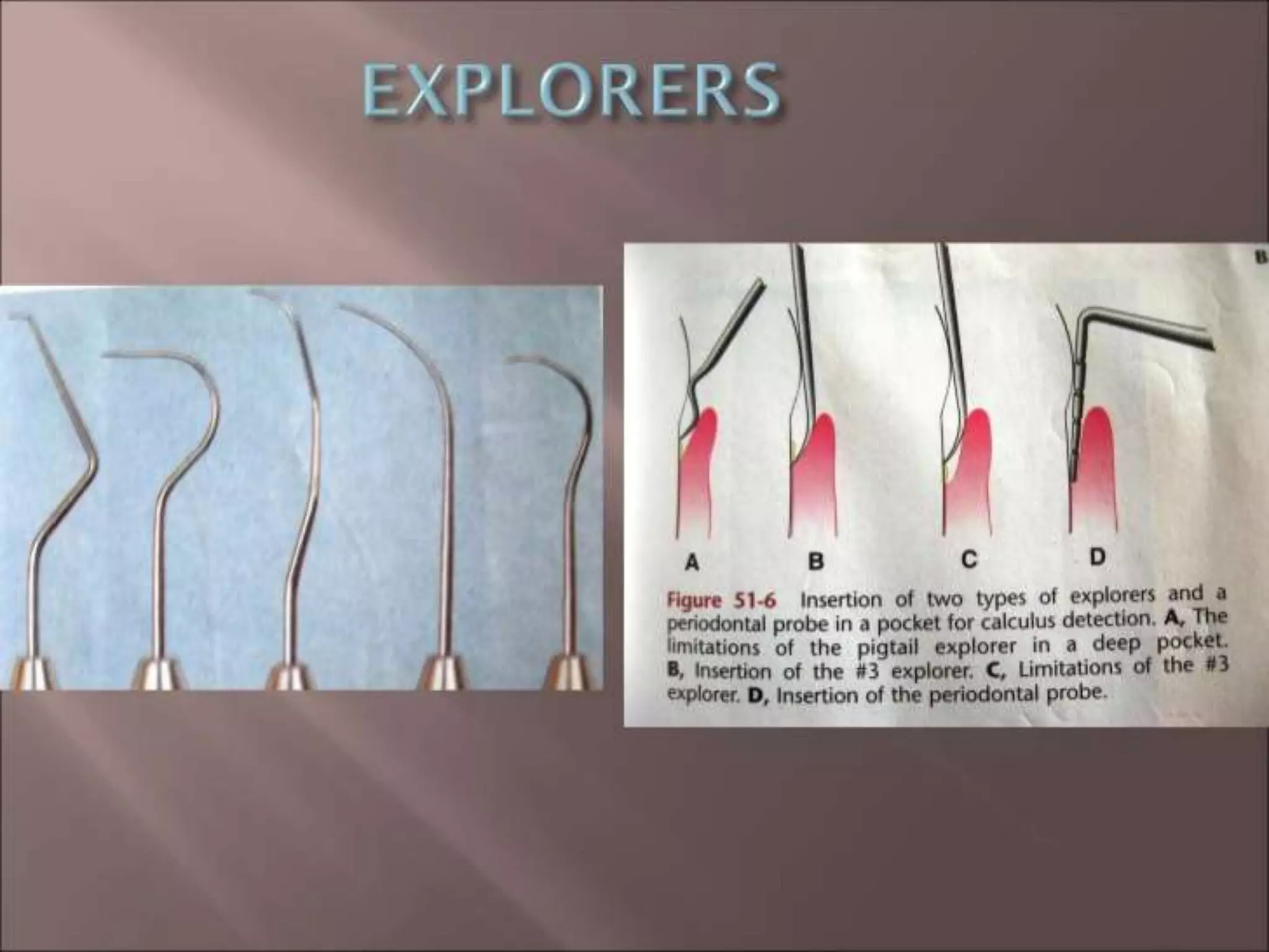 Periodontal instruments | PPTX