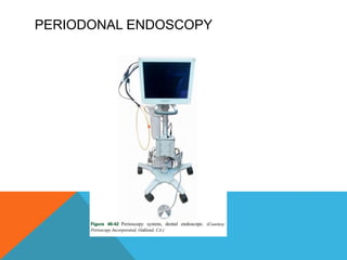 Periodontal,instrumentation,dentistry,dental periodontology, | PPTX