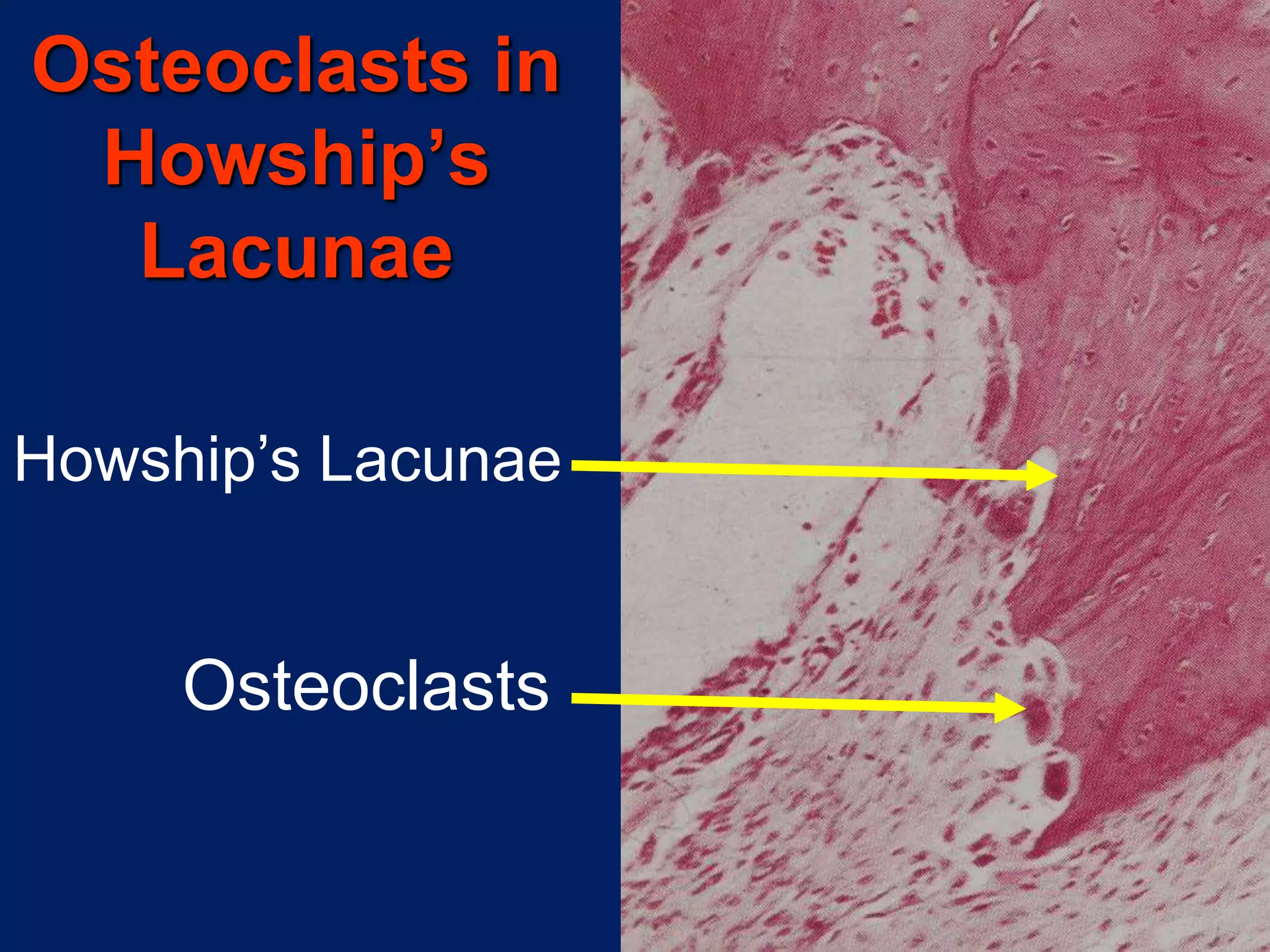 Periodontal Ligament.ppt