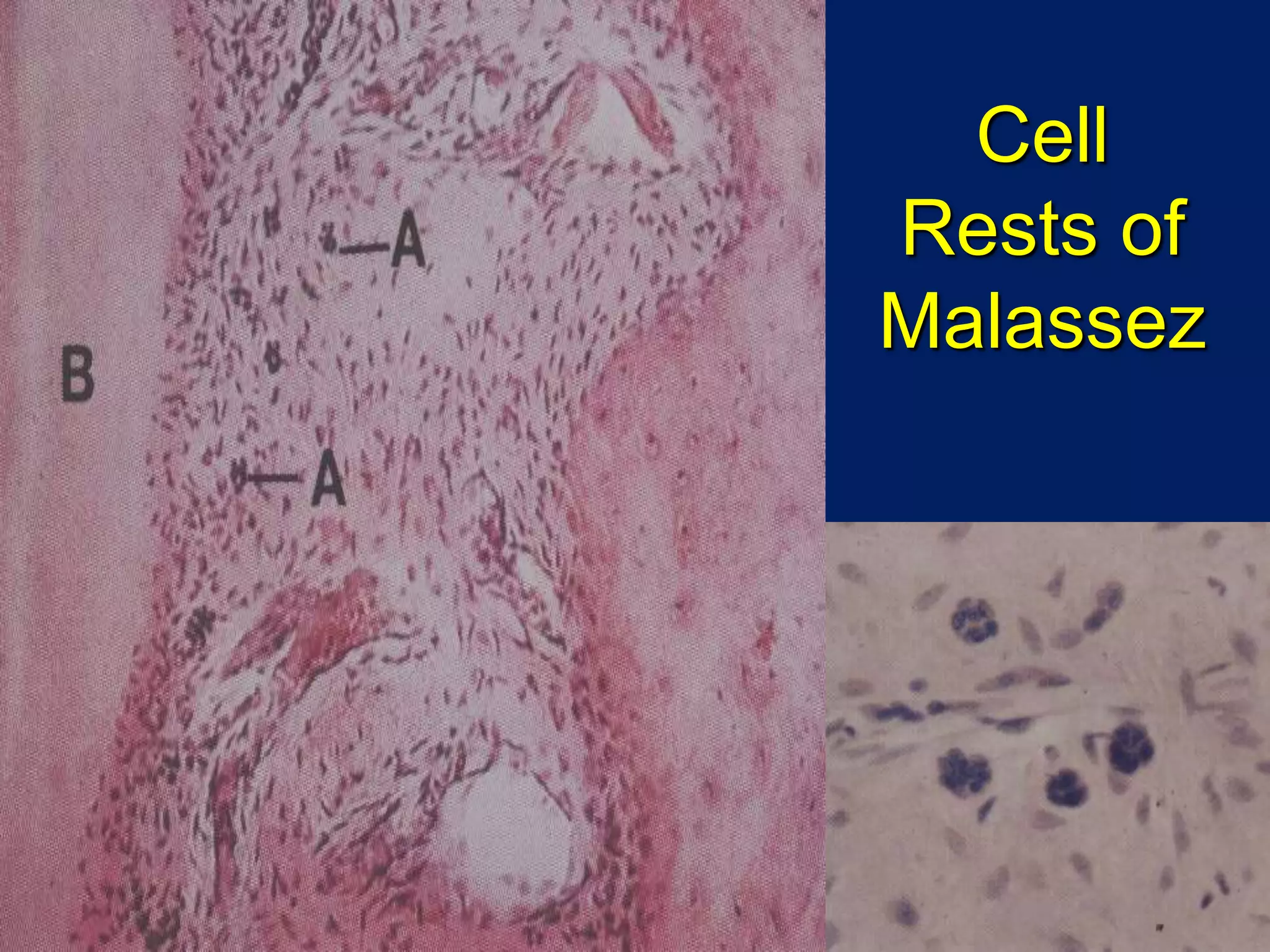 Periodontal Ligament.ppt