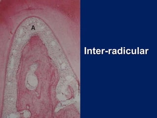 Periodontal Ligament.ppt