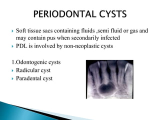 Periodontal ligament in disease | PPTX