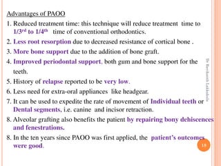 Periodontally accelerated osteogenic osthodontics | PDF