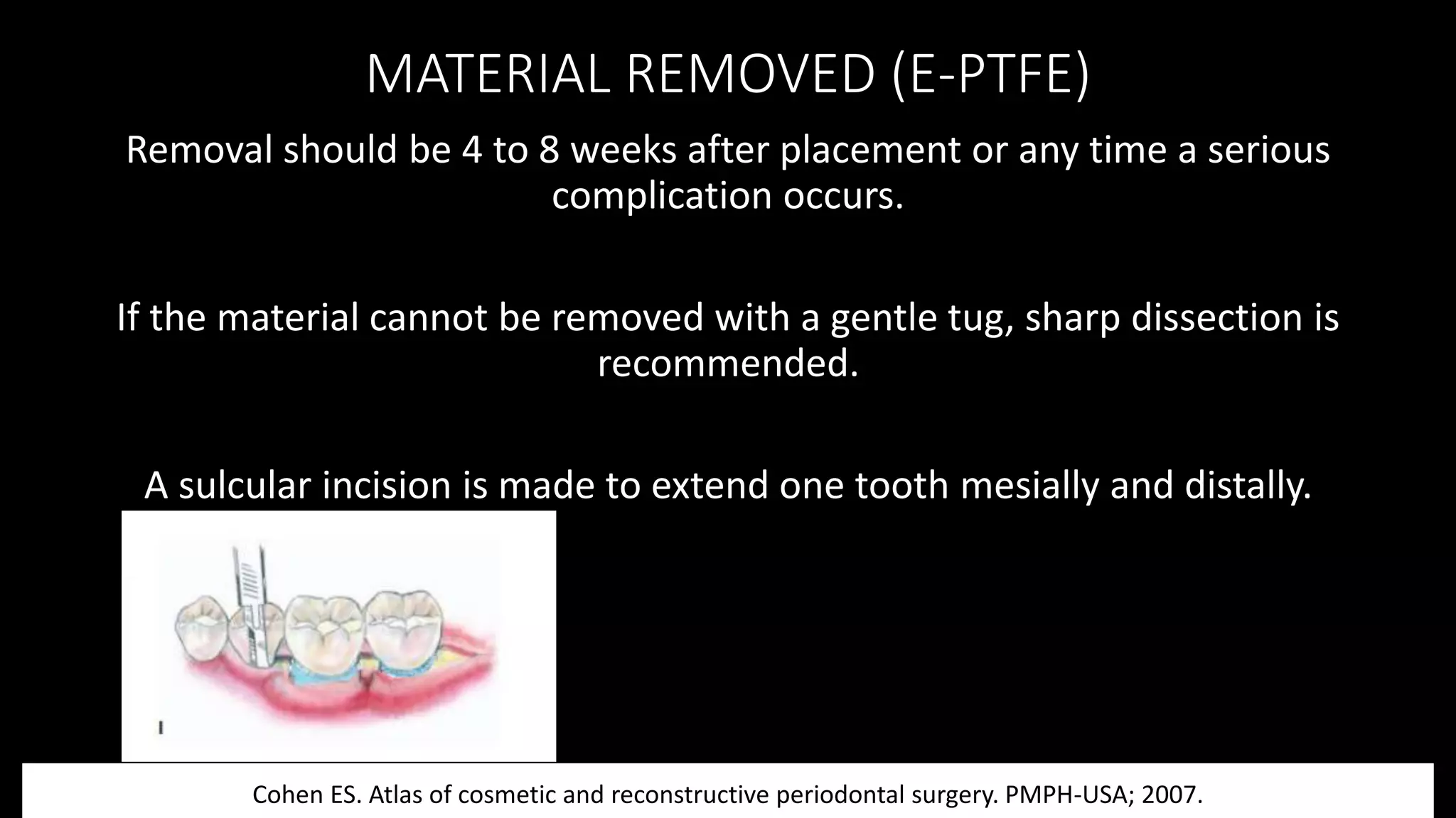 Periodontal membranes – part 2 | PPTX