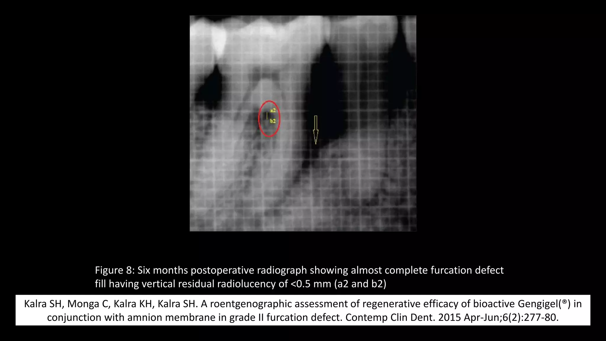 Periodontal membranes – part 2 | PPTX