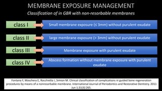 Periodontal membranes – part 2 | PPTX