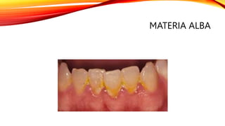 PERIODONTAL MICROBIOLOGY.pptx
