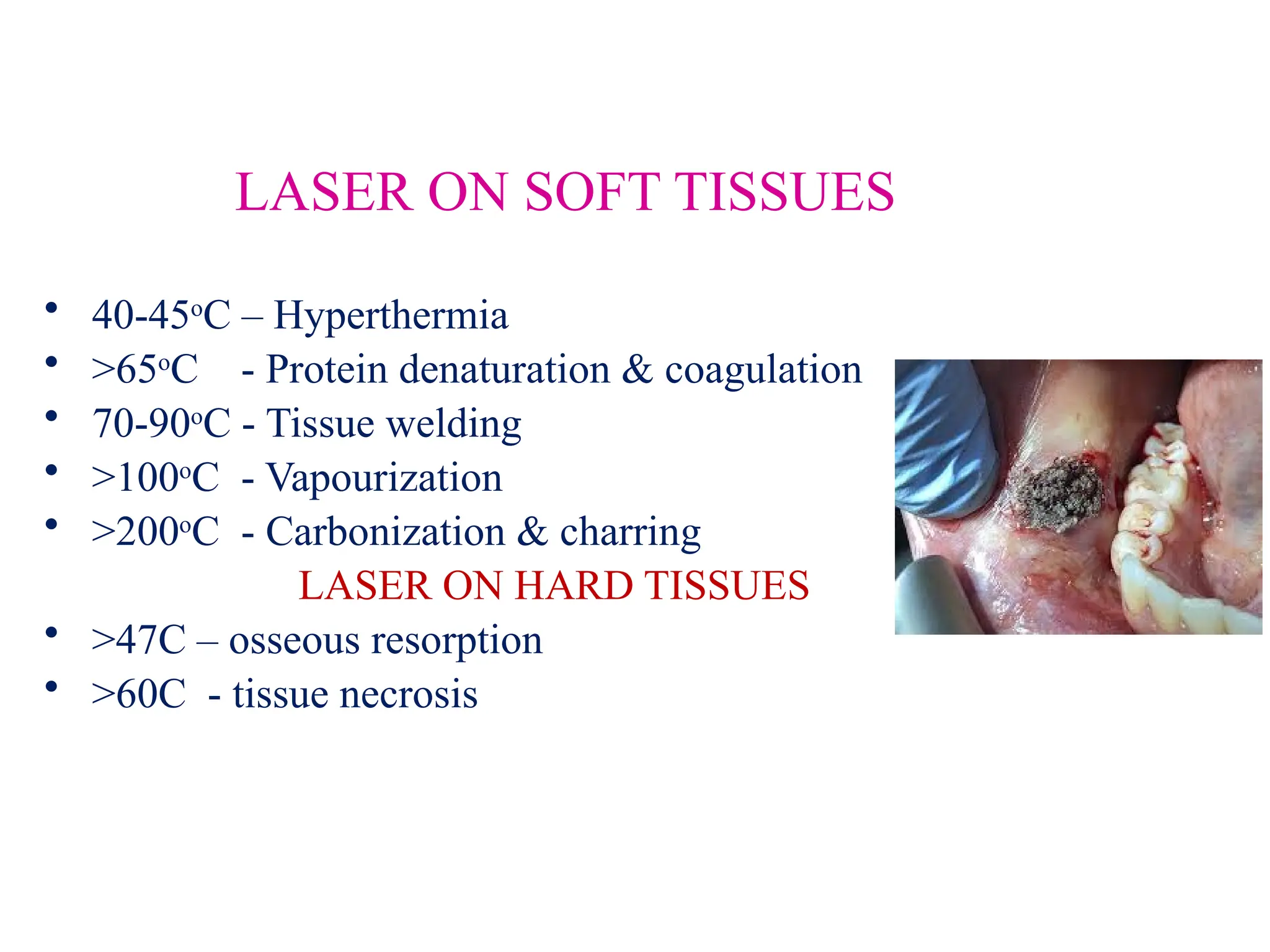 periodontal microsurgery (loupes, microscope).pptx