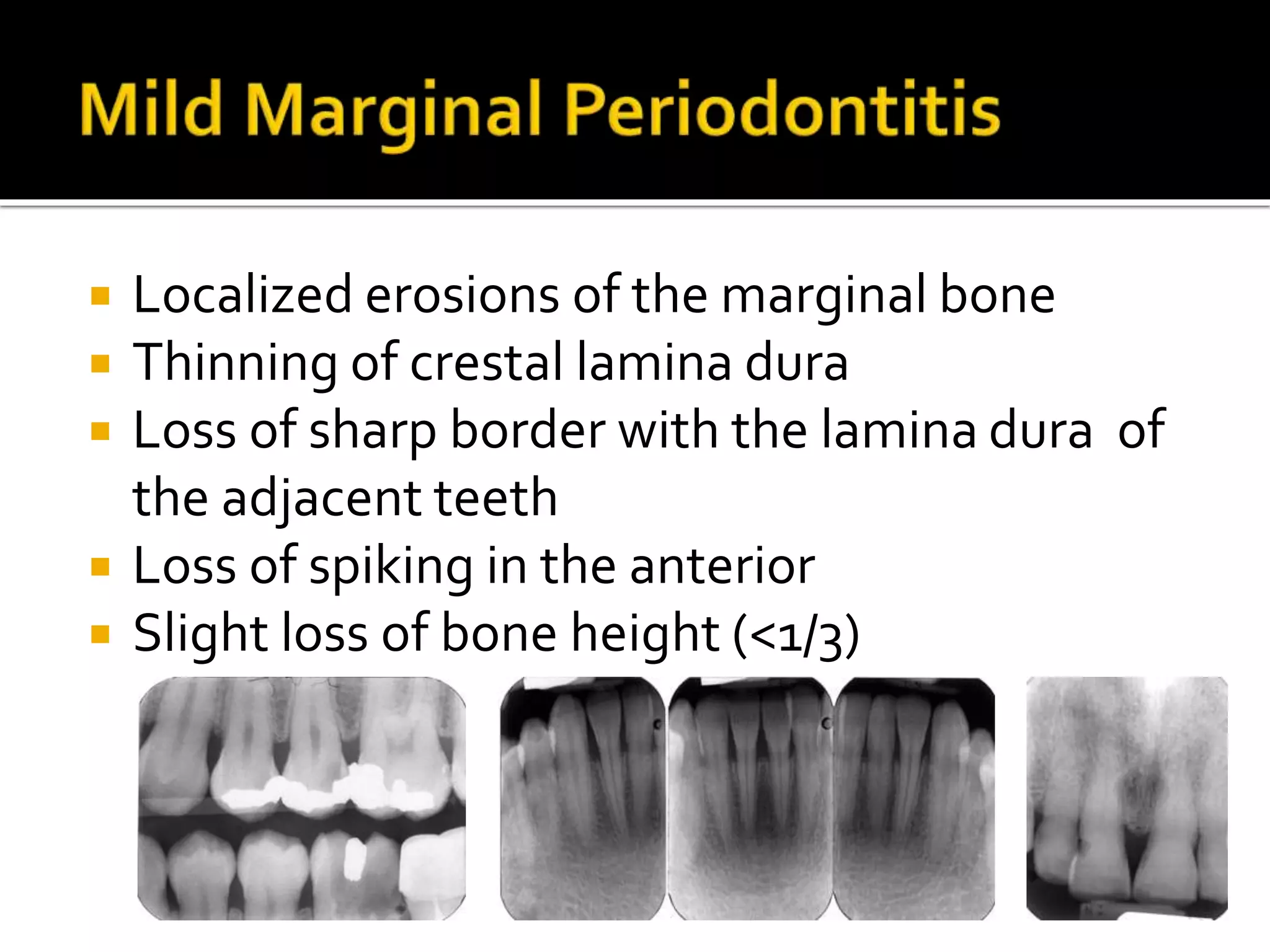 Periodontal Pathology | PPTX