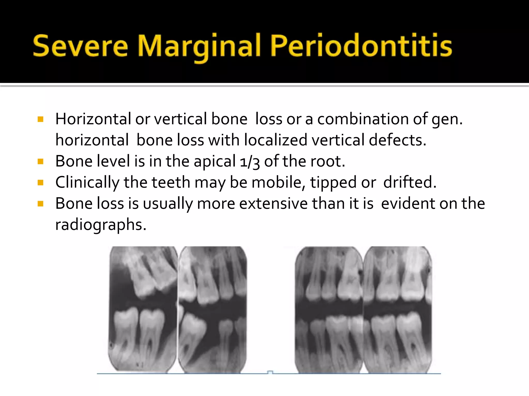 Periodontal Pathology | PPTX