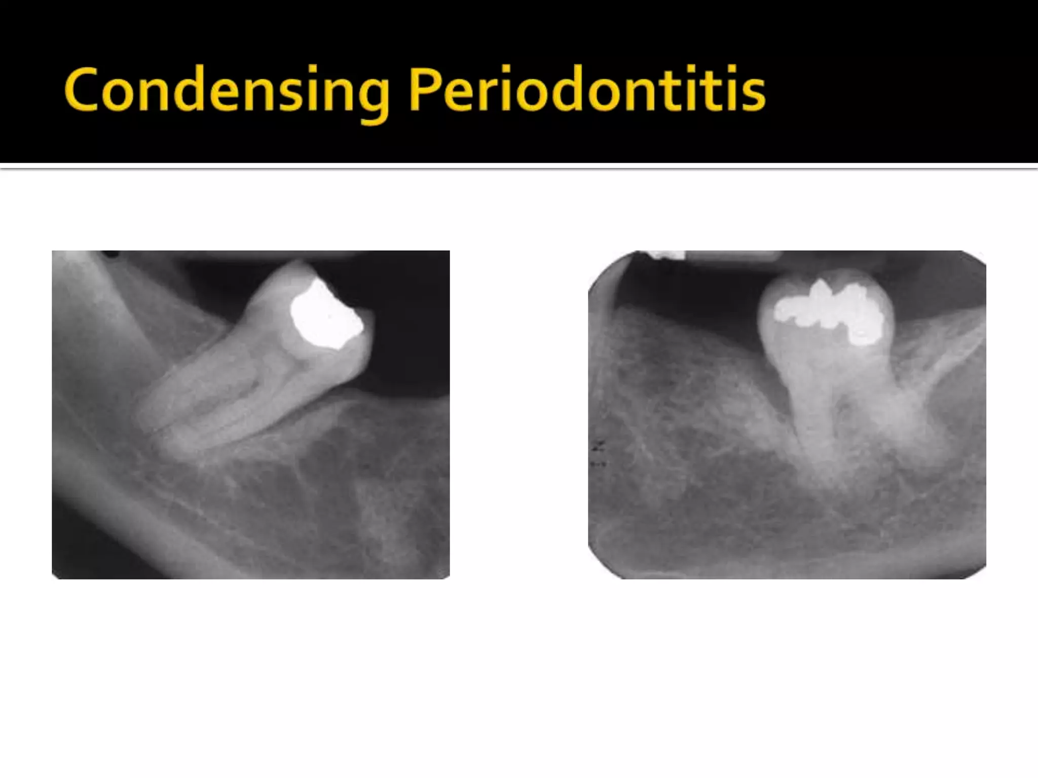Periodontal Pathology | PPTX