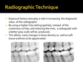 Periodontal Pathology | PPT