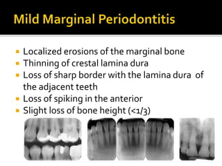 Periodontal Pathology | PPT