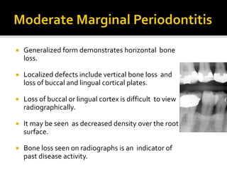 Periodontal Pathology | PPT