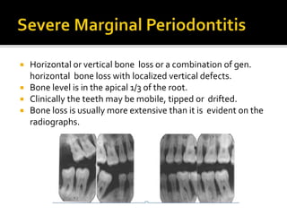 Periodontal Pathology | PPT