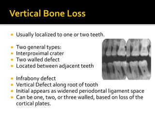 Periodontal Pathology | PPT