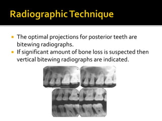 Periodontal Pathology | PPT