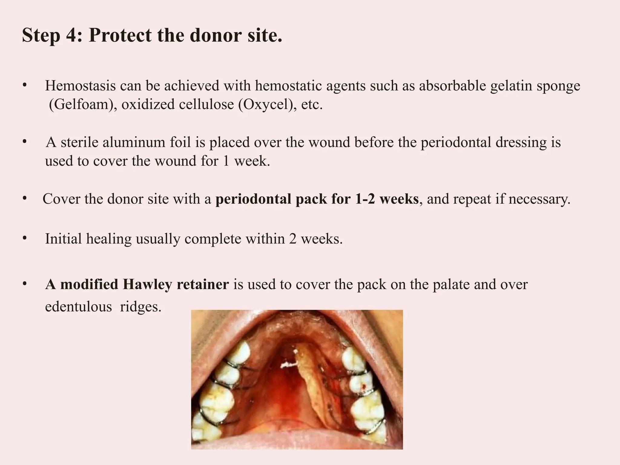 periodontal plastic and esthetic surgery.pptx