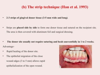 periodontal plastic and esthetic surgery.pptx