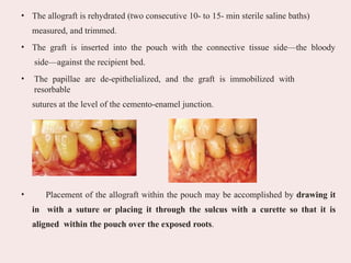 periodontal plastic and esthetic surgery.pptx