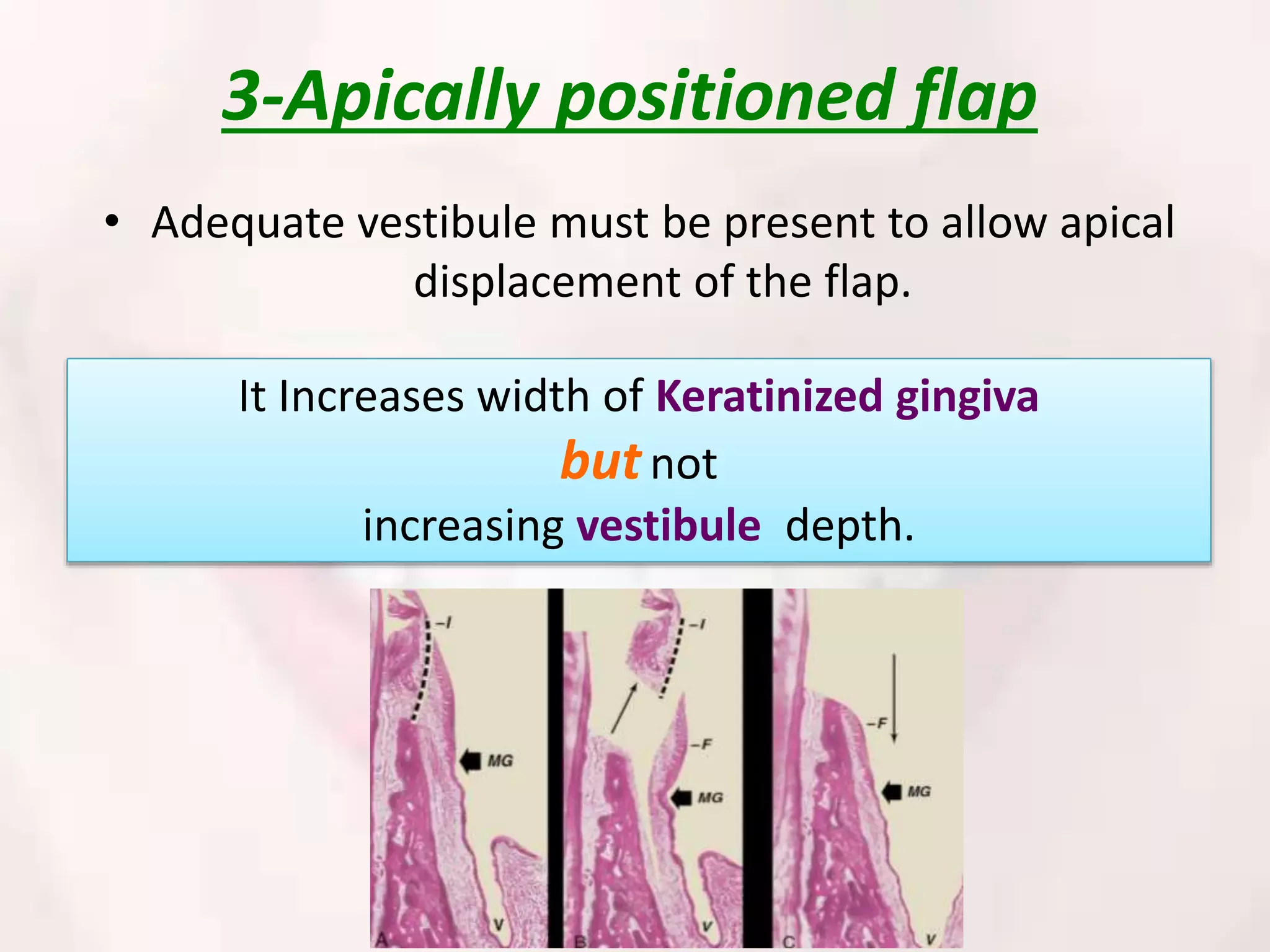 Periodontal plastic and esthetic surgery | PPTX
