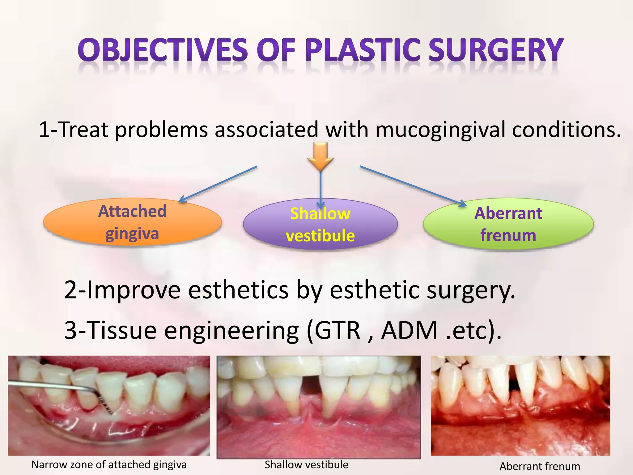 Periodontal plastic and esthetic surgery | PPTX