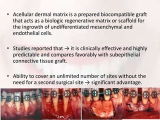 Periodontal plastic and esthetic surgery | PPTX