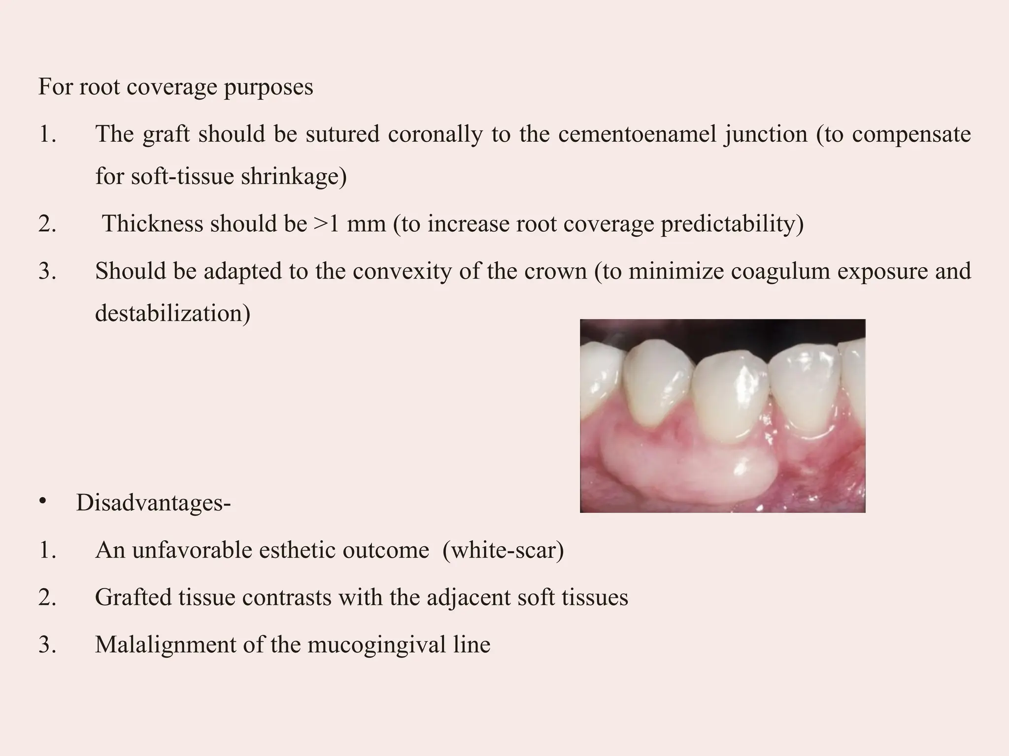 periodontalplasticestheticsurgery.pptx . | PPTX