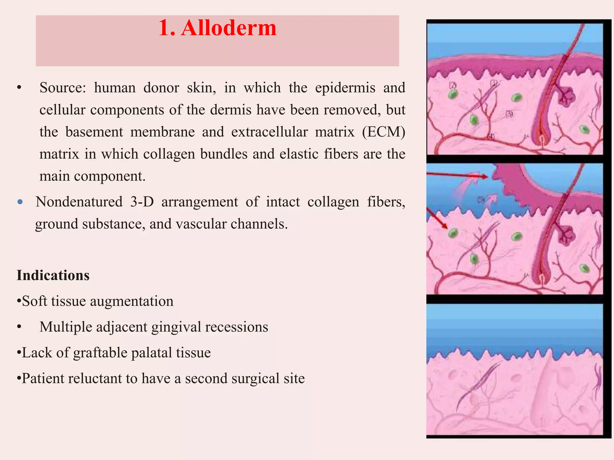 Periodontal plastic & esthetic surgery | PPTX
