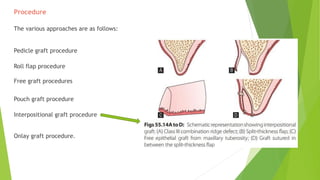 Periodontal plastic surgery | PDF