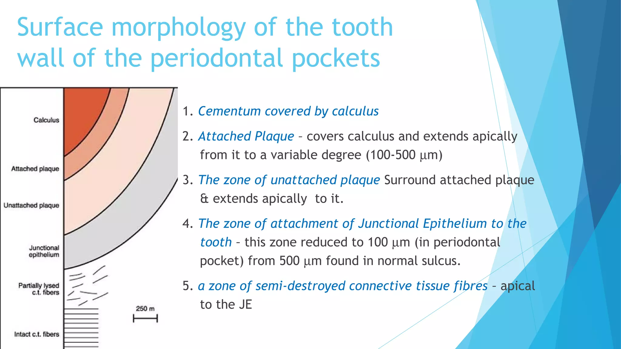 Periodontal pocket | PPT