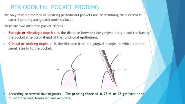 Periodontal pocket