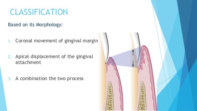 Periodontal pocket