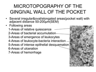 PERIODONTAL_POCKET-16-12-14.ppt