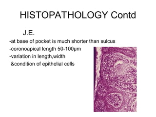 PERIODONTAL_POCKET- Pathogenesis and formation.ppt
