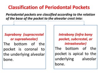 Periodontal pocket | PPTX