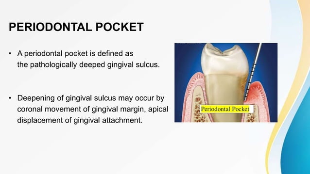 Periodontal pocket , Gingival Recession , Tooth mobility | PPTX | Oral ...