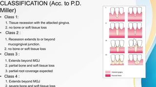 Periodontal pocket , Gingival Recession , Tooth mobility | PPT