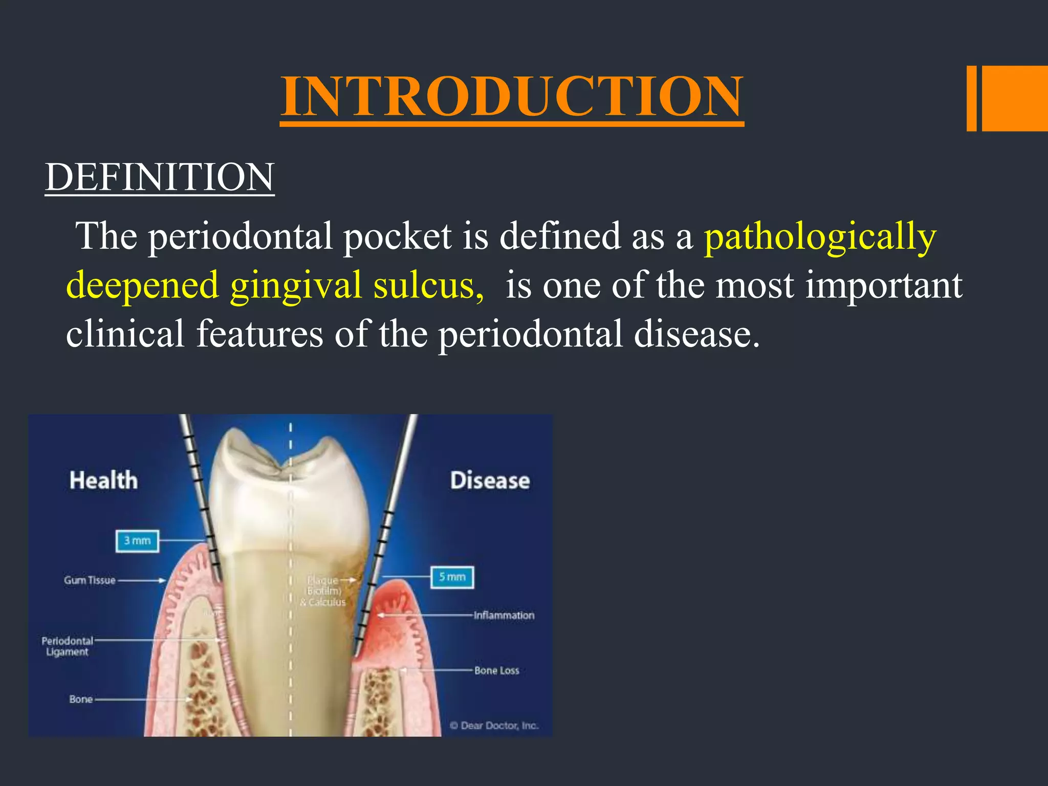 PERIODONTAL POCKET.pptx