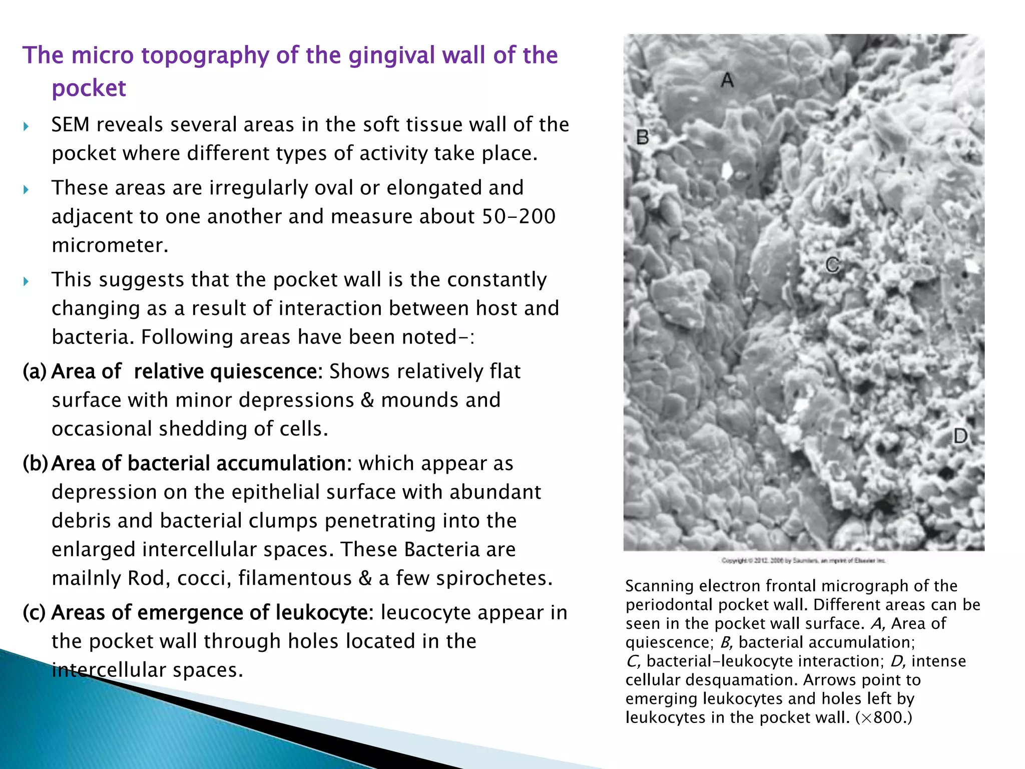 Periodontal Pocket | PPTX
