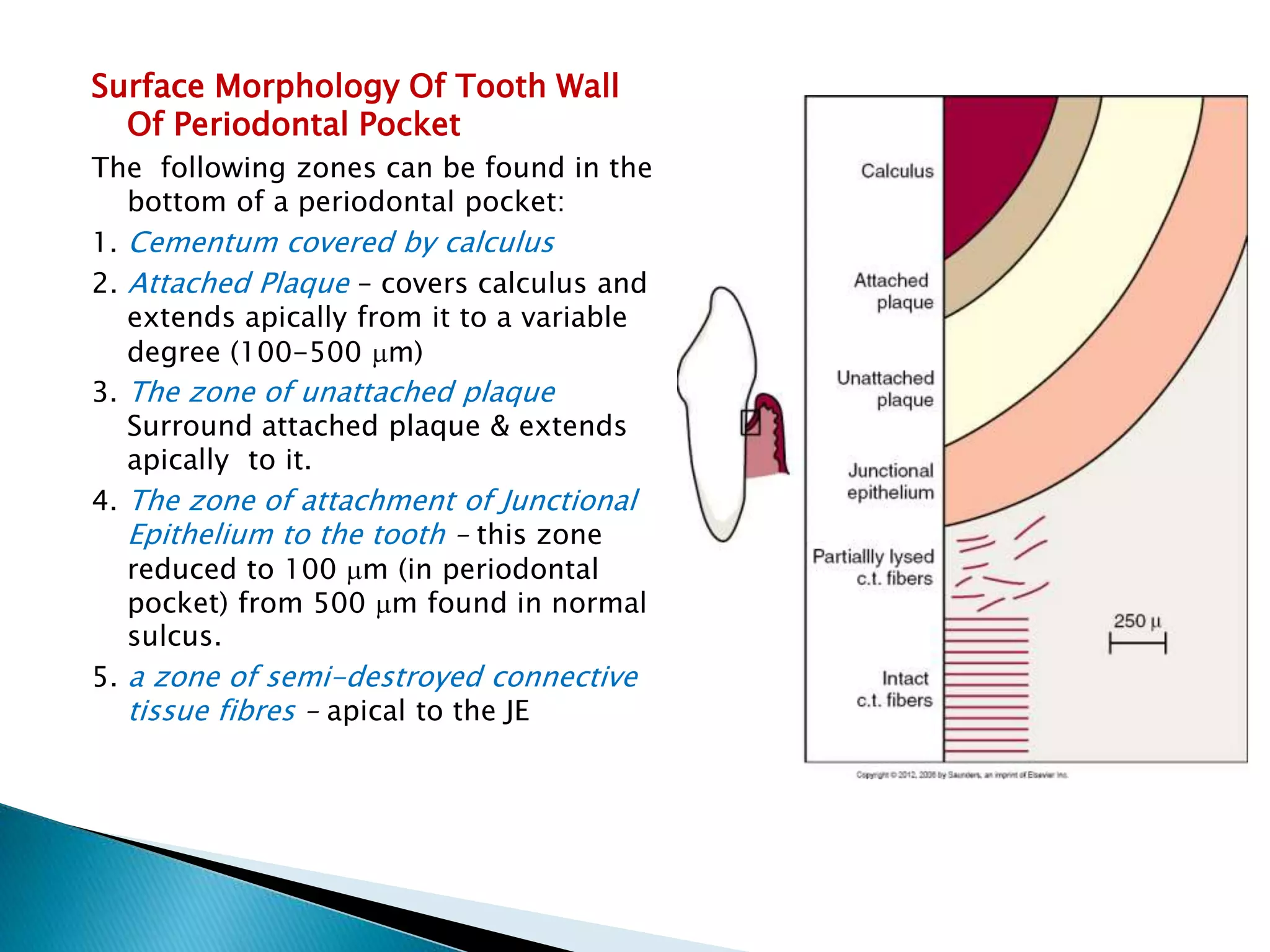 Periodontal Pocket | PPTX