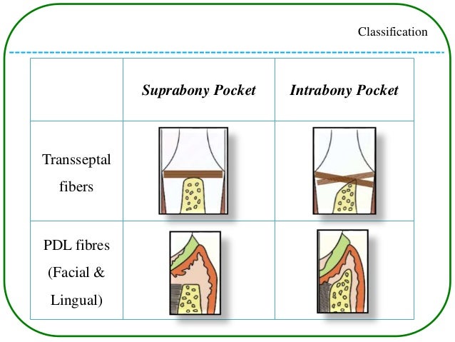 Periodontal pockets