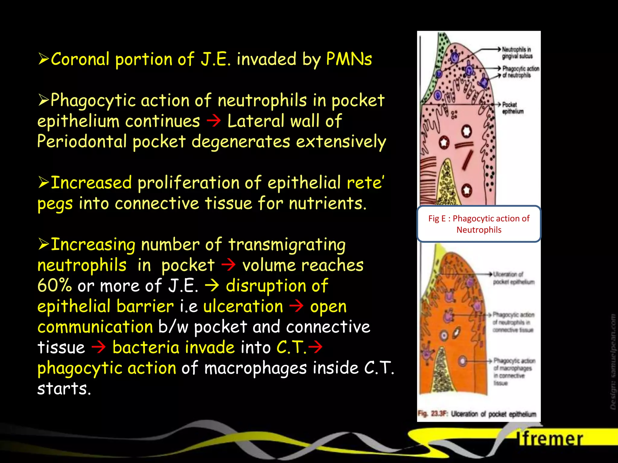 Periodontal pockets & it's pathogenesis | PPTX