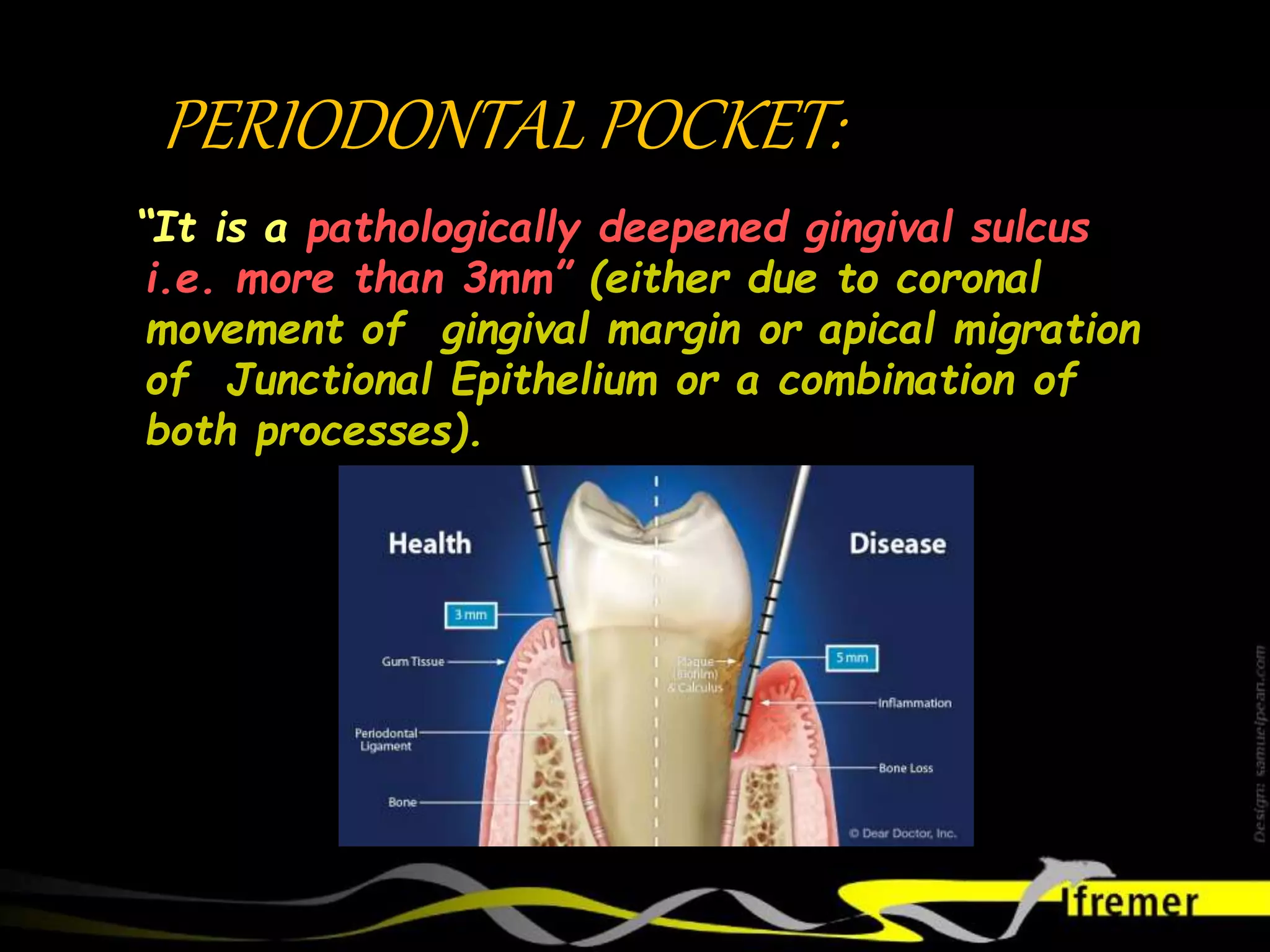 Periodontal pockets & it's pathogenesis | PPTX