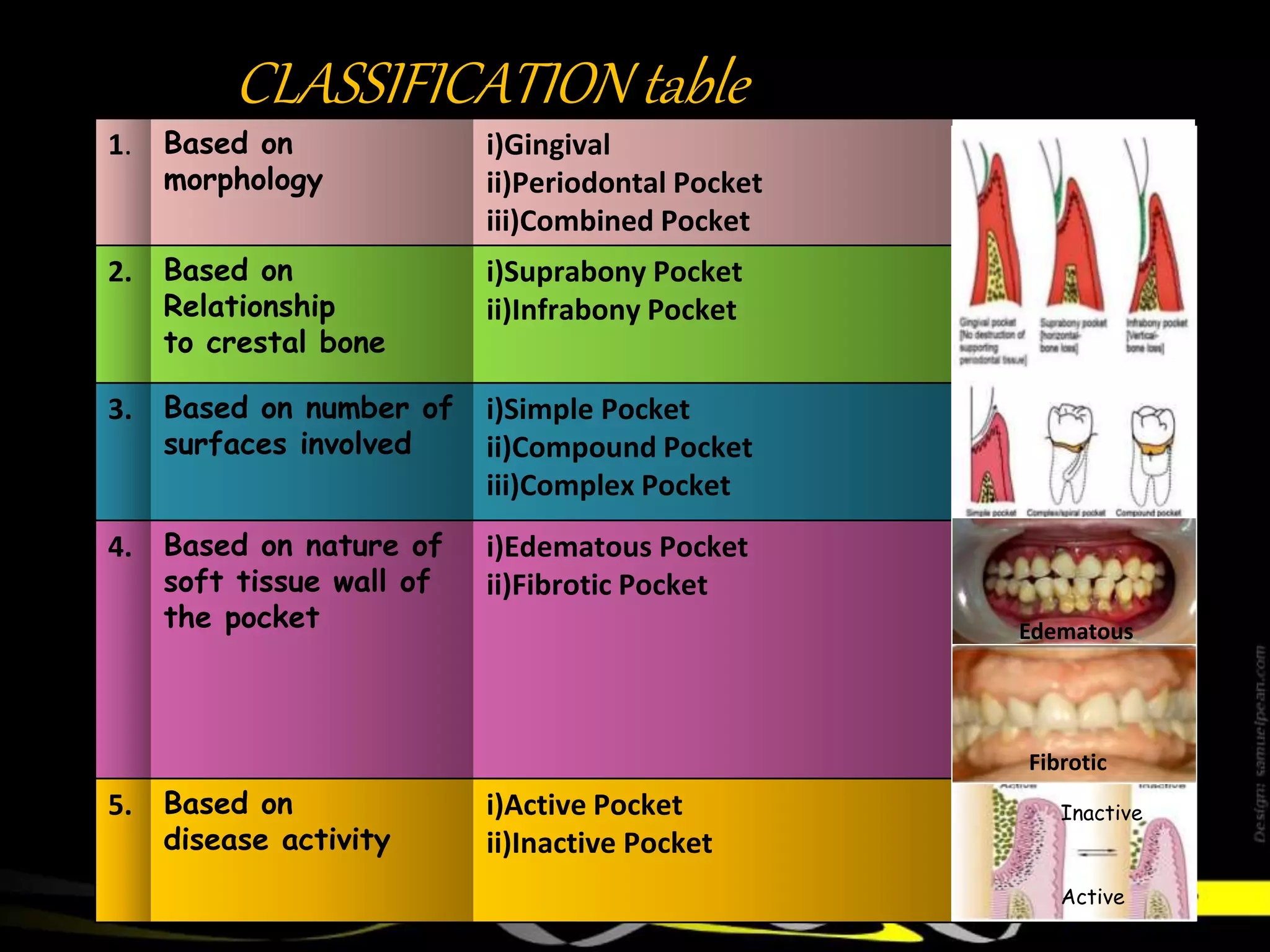 Periodontal pockets & it's pathogenesis | PPTX
