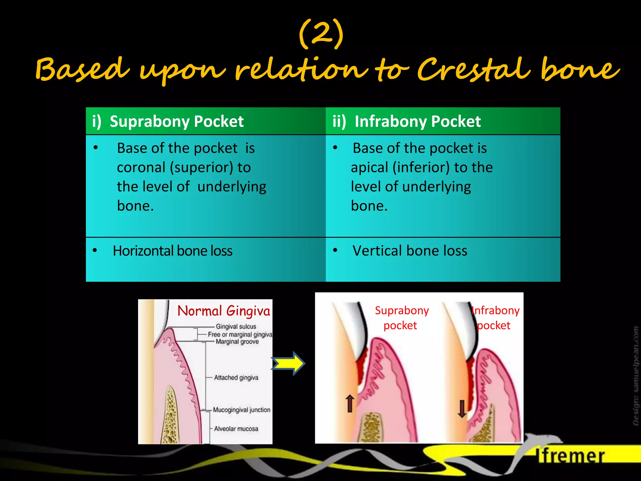 Periodontal pockets & it's pathogenesis | PPTX