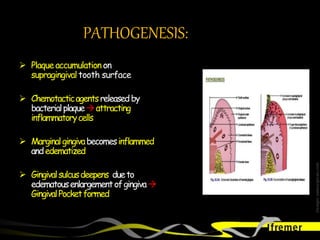 Periodontal pockets & it's pathogenesis | PPTX